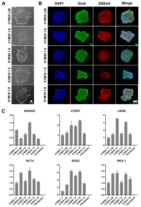 Human iPSC-Derived Muscle Cells as a New Model for Investigation of ...
