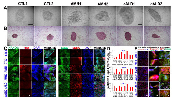 Generation and Characterization of Human iPSC-Derived Astrocytes with ...
