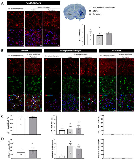 Spatio-Temporal Characterization of Cellular Senescence Hallmarks in Experimental Ischemic Stroke