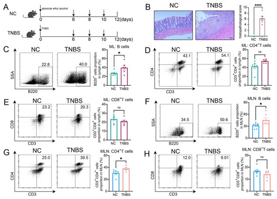 Mesenteric Lymphatic B Cells Migrate to the Gut and Aggravate TNBS ...