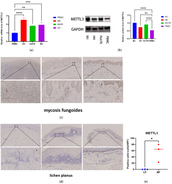 METTL3 Promotes Cutaneous T-Cell Lymphoma Progression by Regulating ...