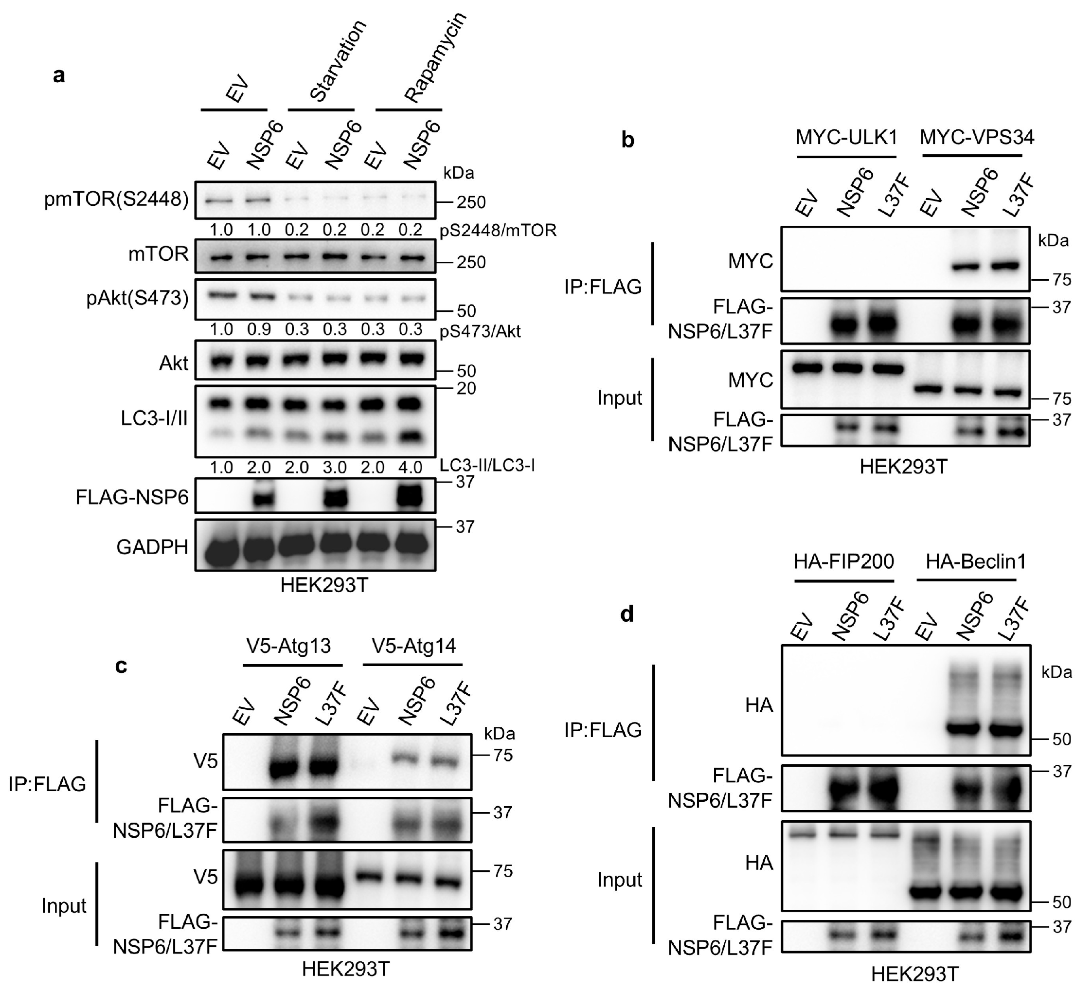 NSP6 of SARS-CoV-2 Dually Regulates Autophagic–Lysosomal Degradation