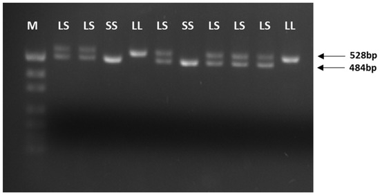 Analysis of Serotonin Transporter Gene 5-HTTLPR Polymorphism and Its ...