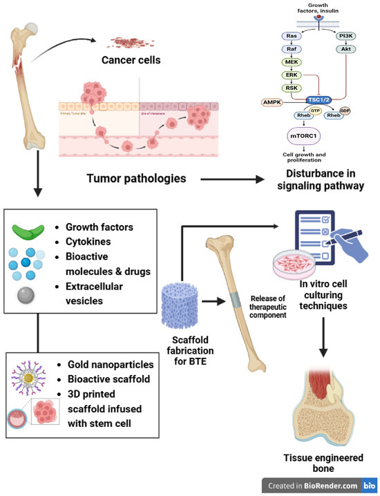 Innovative Approaches in Bone Tissue Engineering: Strategies for Cancer ...