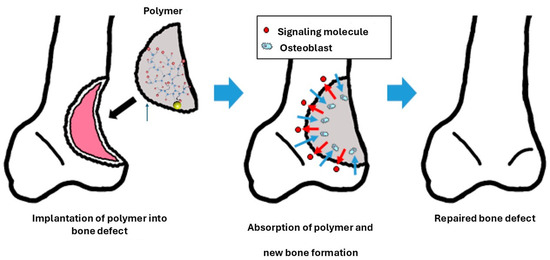 Evolution in Bone Tissue Regeneration: From Grafts to Innovative ...
