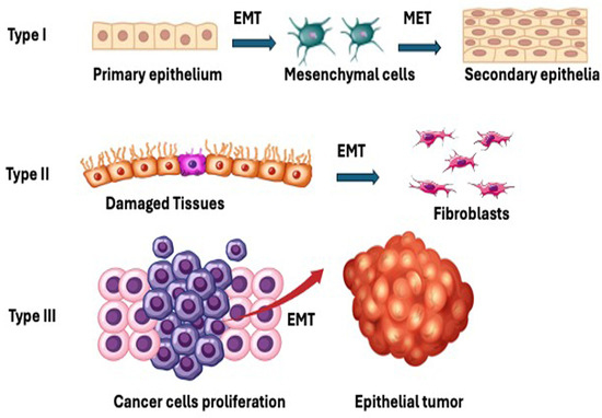 Molecular Mechanisms Regulating Epithelial Mesenchymal Transition (EMT ...