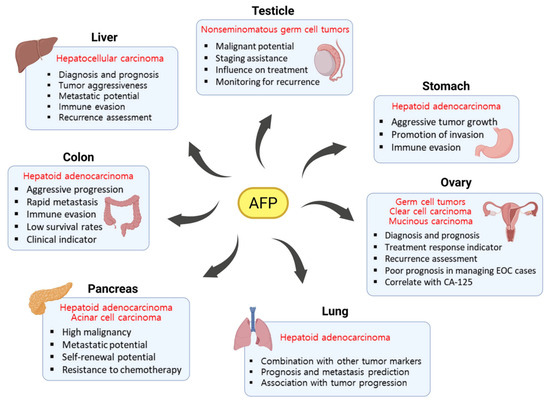 Exploring the Multifunctional Role of Alpha-Fetoprotein in Cancer ...
