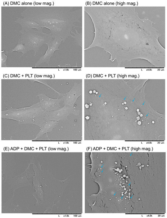 Mitochondrial Transfer from Human Platelets to Rat Dental Pulp-Derived ...