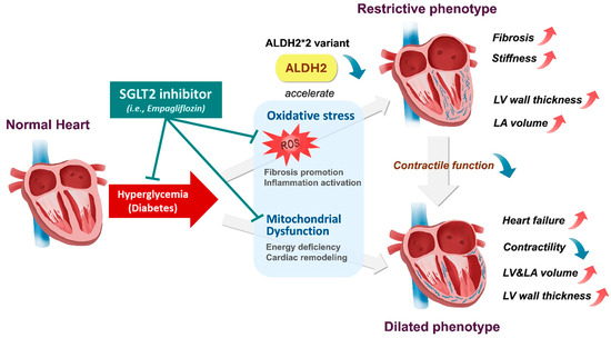 ALDH2 Enzyme Deficiency in Diabetic Cardiomyopathy