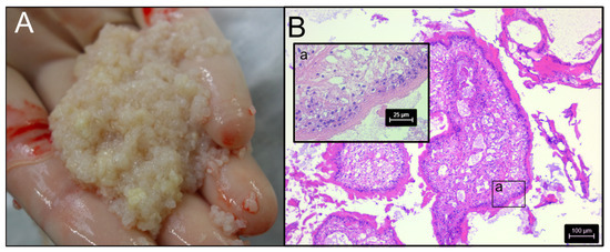 Chromosome-Contiguous Reference Genome for Spirometra to Underpin ...