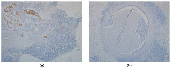 Evidence for the Prognostic Value of CDH17 Expression in Colorectal ...