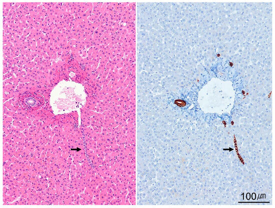 Histological and Molecular Evaluation of Liver Biopsies: A Practical ...