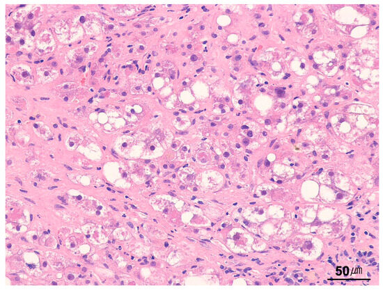 Histological and Molecular Evaluation of Liver Biopsies: A Practical ...