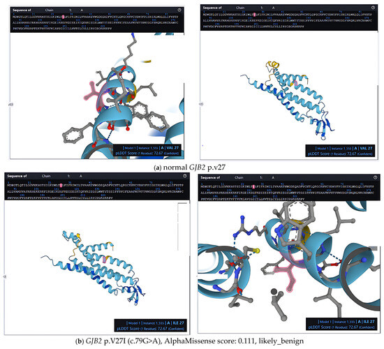 Mutation Spectrum of GJB2 in Taiwanese Patients with Sensorineural ...
