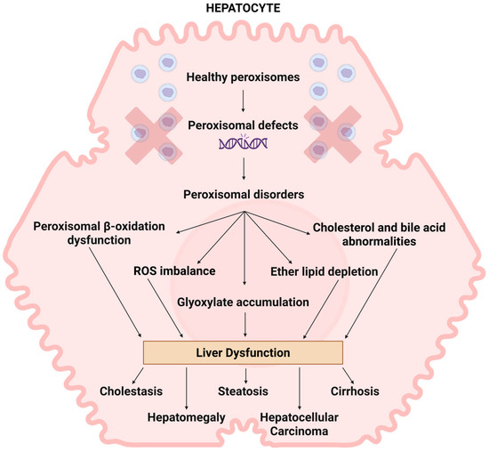 Peroxisome Dysfunction and Steatotic Liver Disease