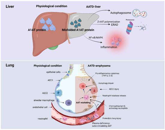 Next-Generation Regenerative Therapies for Alpha-1 Antitrypsin ...