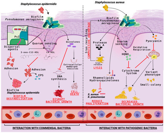 Pseudomonas aeruginosa Pathogenicity and Its Interaction with Other ...