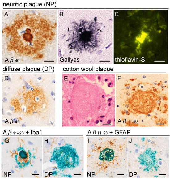 The Determinant of Tau Spreading in Alzheimer’s Disease: Dependent on ...