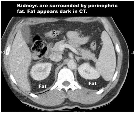 IJTM | Free Full-Text | A Review of High-Intensity Focused Ultrasound