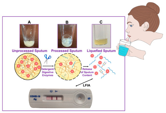 Human Sputum Proteomics: Advancing Non-Invasive Diagnosis of ...