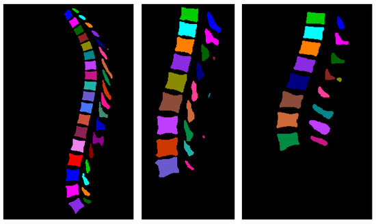 Segmentation and Identification of Vertebrae in CT Scans Using CNN, k-Means Clustering and k-NN