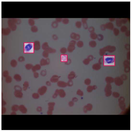 Classification of Malaria Using Object Detection Models