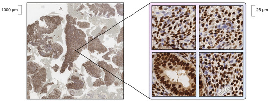 Informatics | Free Full-Text | EndoNet: A Model for the Automatic ...