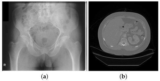 The Current Role of Image Compression Standards in Medical Imaging