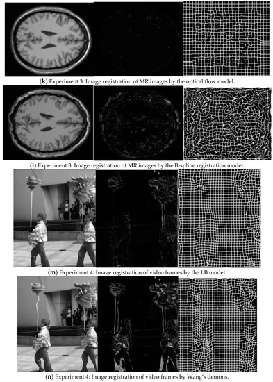 A Parallel Image Registration Algorithm Based on a Lattice Boltzmann Model