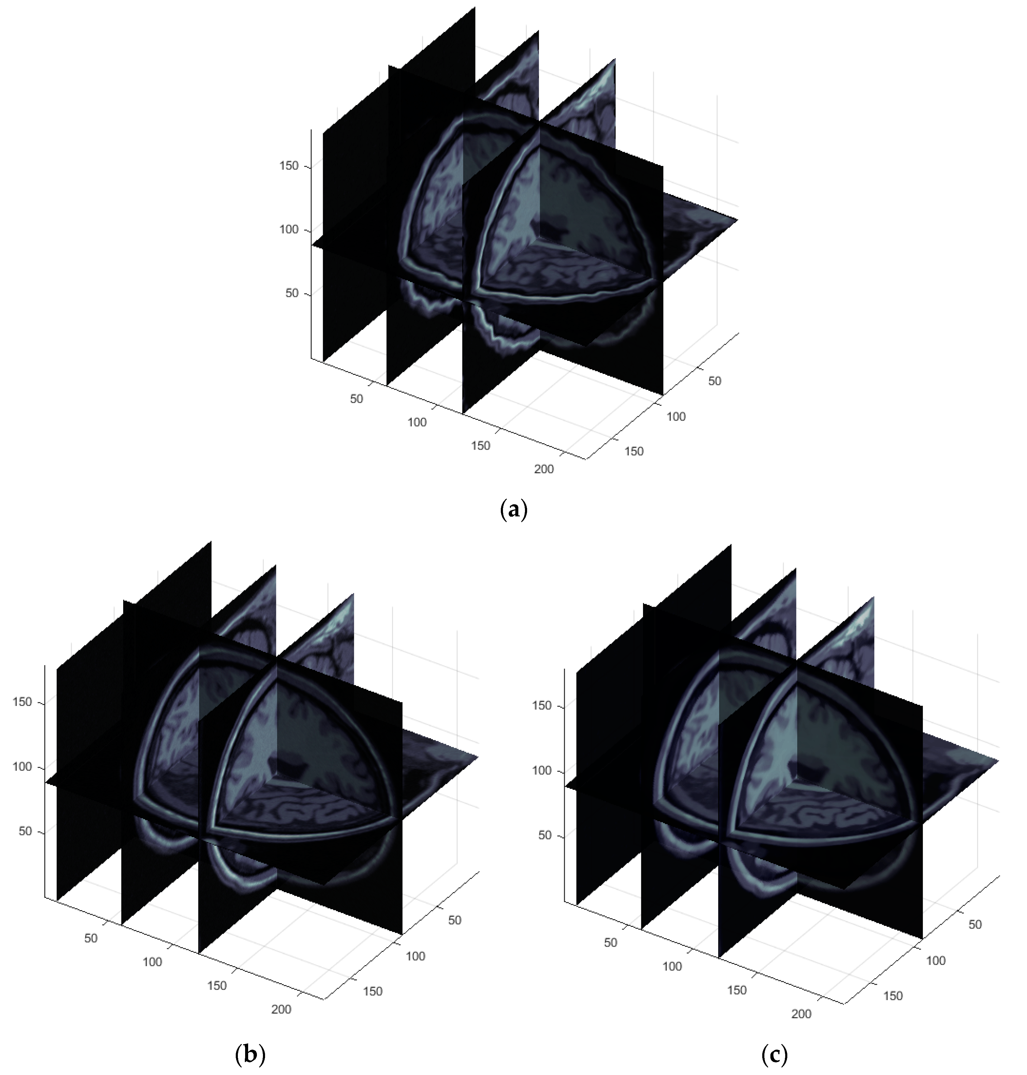 A Parallel Image Registration Algorithm Based on a Lattice Boltzmann Model