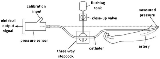Screening System for Cardiac Problems through Non-Invasive ...