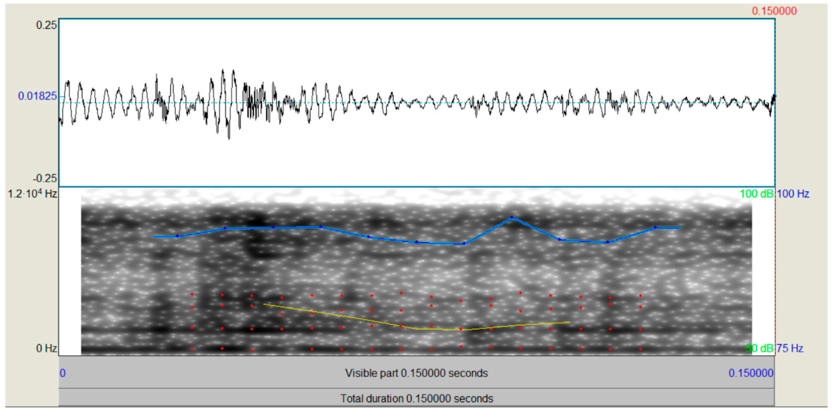 An Innovative Acoustic Rain Gauge Based on Convolutional Neural Networks