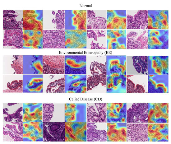 Information | Free Full-Text | HMIC: Hierarchical Medical Image ...