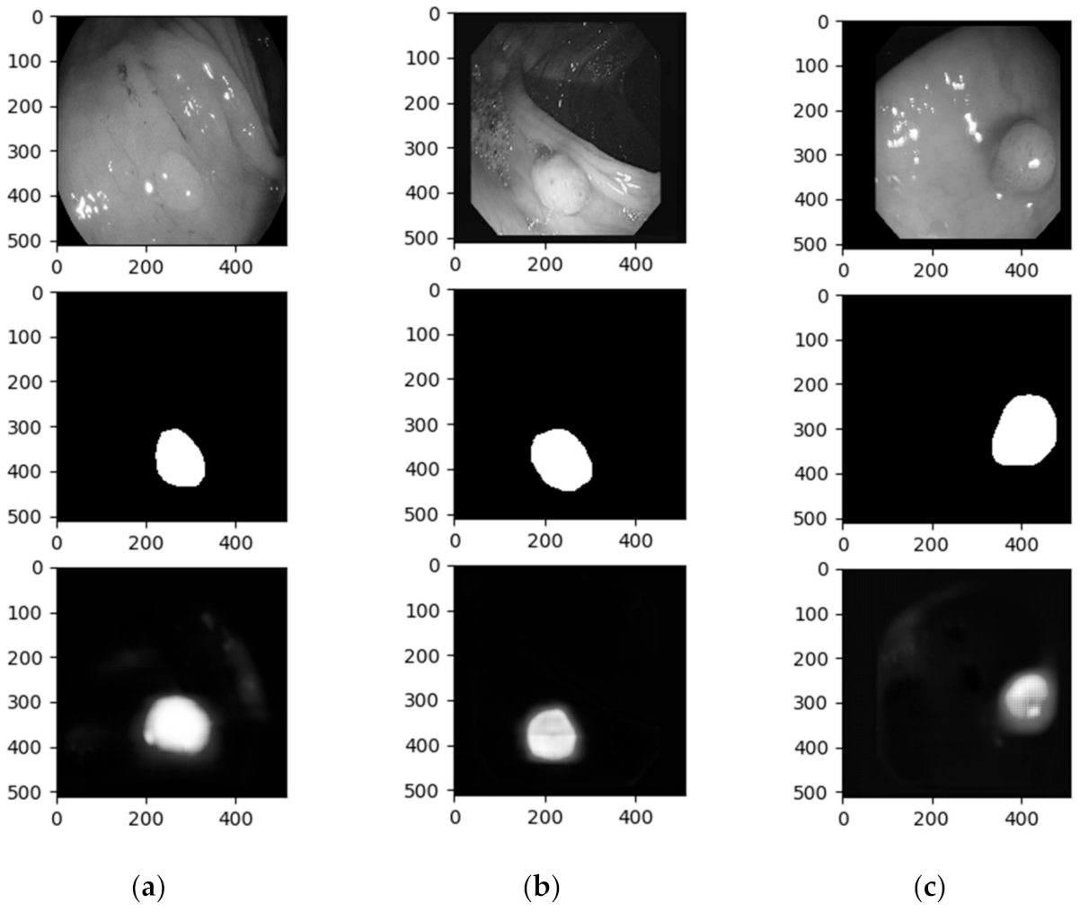 Information Free Full Text Deep Learning Models For Colorectal Polyps