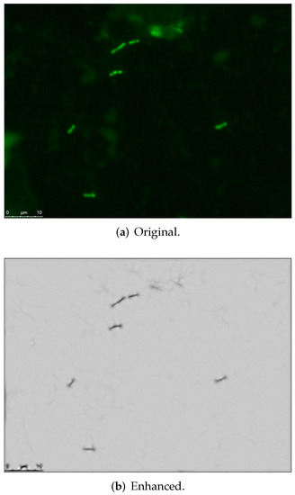 Tuberculosis Bacteria Detection and Counting in Fluorescence Microscopy ...