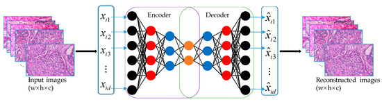 Breast Histopathological Image Classification Method Based on ...