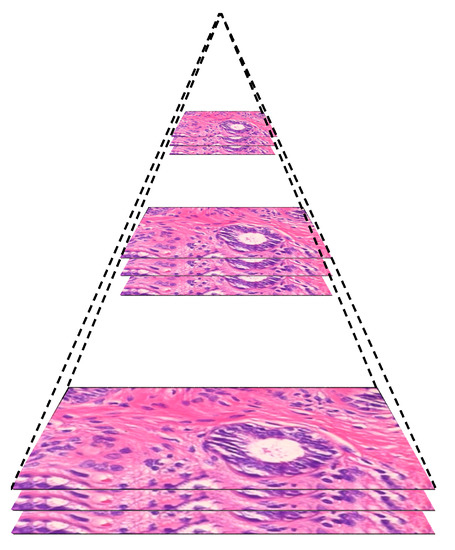 Breast Histopathological Image Classification Method Based on Autoencoder and Siamese Framework