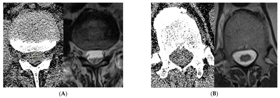 Information | Special Issue : Stitching, Alignment and Segmentation ...