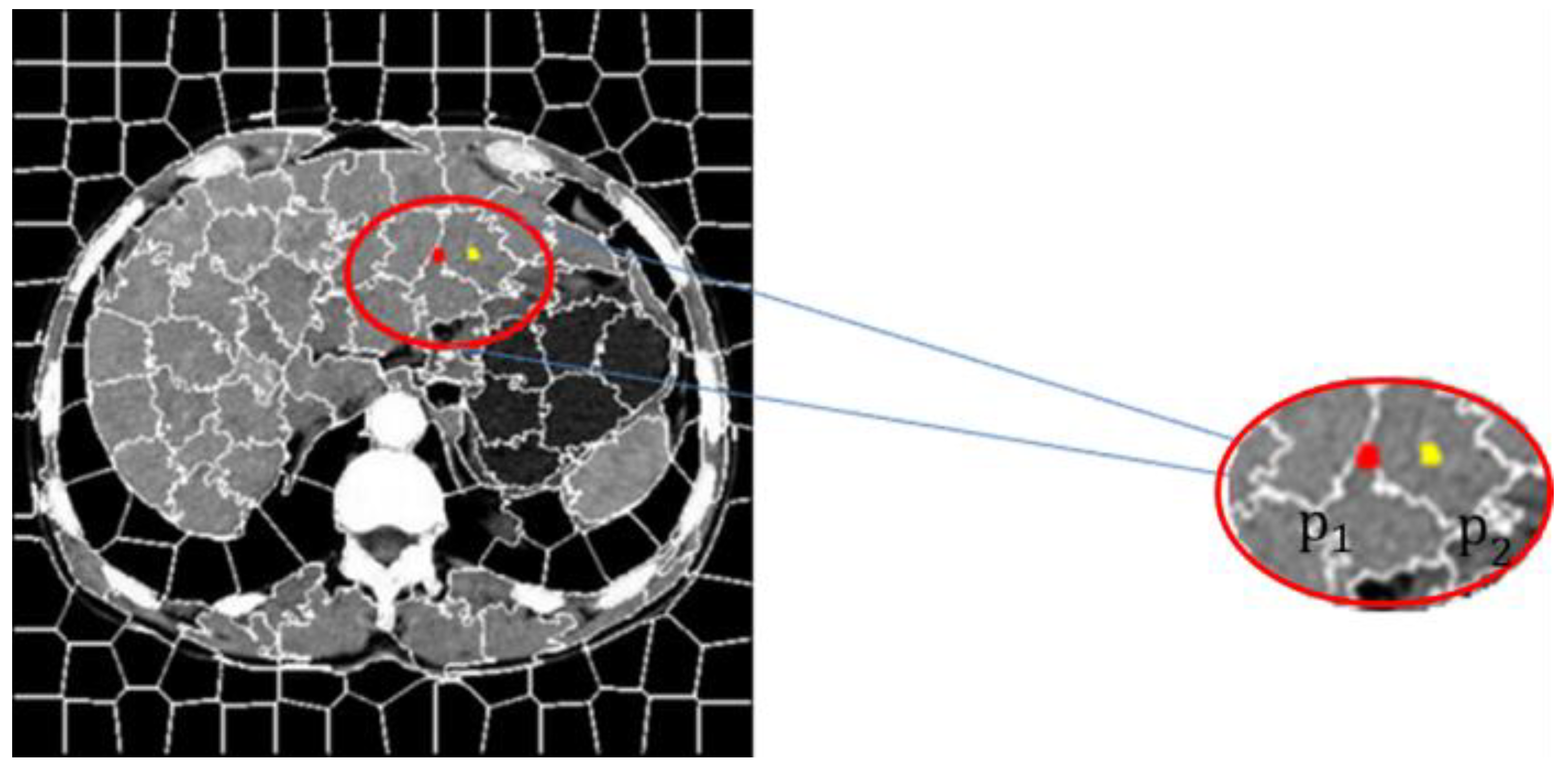 Liver CT Image Recognition Method Based on Capsule Network