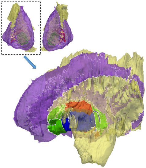 Atlas-Based Shared-Boundary Deformable Multi-Surface Models through Multi-Material and Two ...