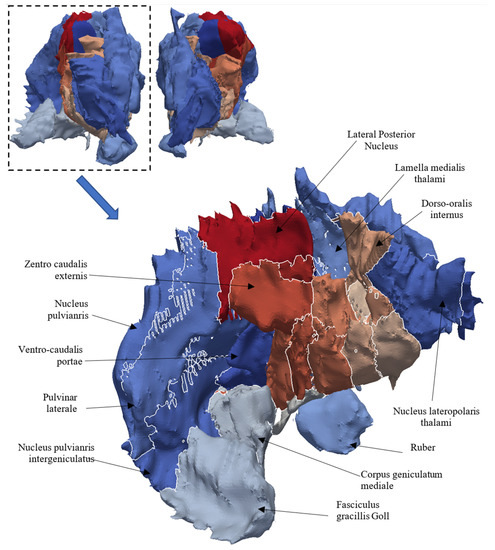 Atlas-Based Shared-Boundary Deformable Multi-Surface Models through Multi-Material and Two ...