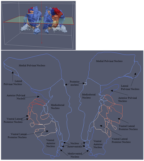 Atlas-Based Shared-Boundary Deformable Multi-Surface Models through Multi-Material and Two ...