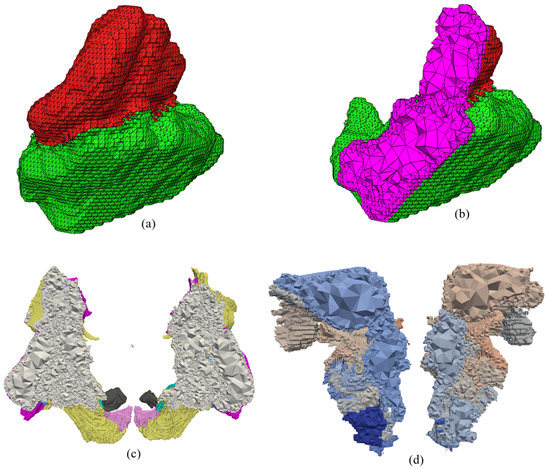 Information | Free Full-Text | Atlas-Based Shared-Boundary Deformable Multi-Surface Models ...