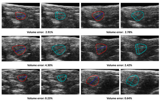 Assessing Cardiac Functions of Zebrafish from Echocardiography Using Deep Learning