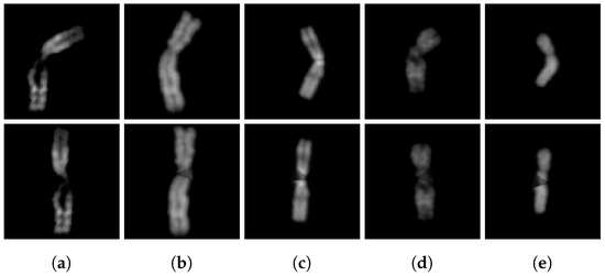 Information | Free Full-Text | Deep-Learning-Based Human Chromosome Classification: Data ...