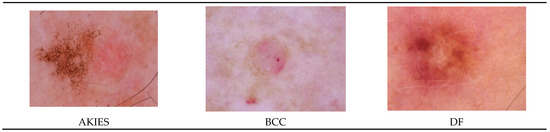 Multi-Class Skin Cancer Classification Using Vision Transformer ...