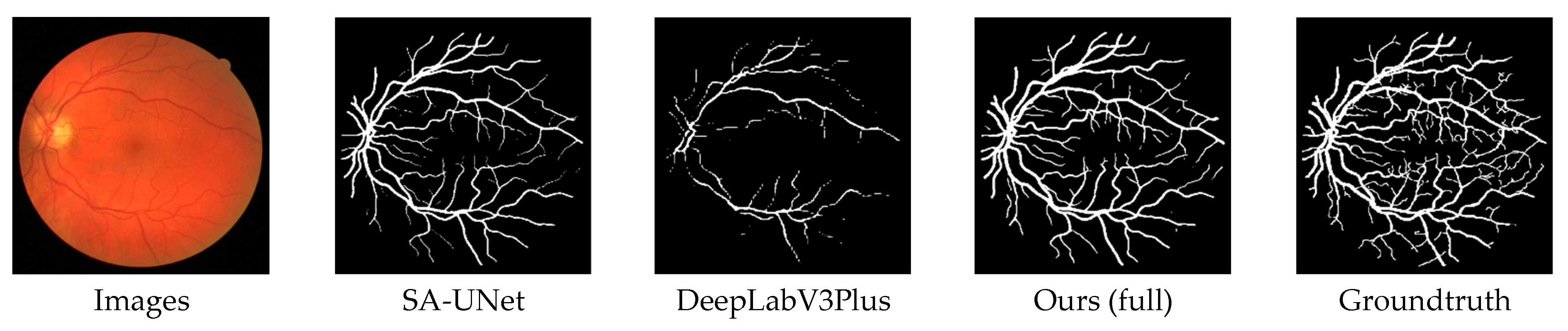 Information | Free Full-Text | Dual-Pyramid Wide Residual Network for ...