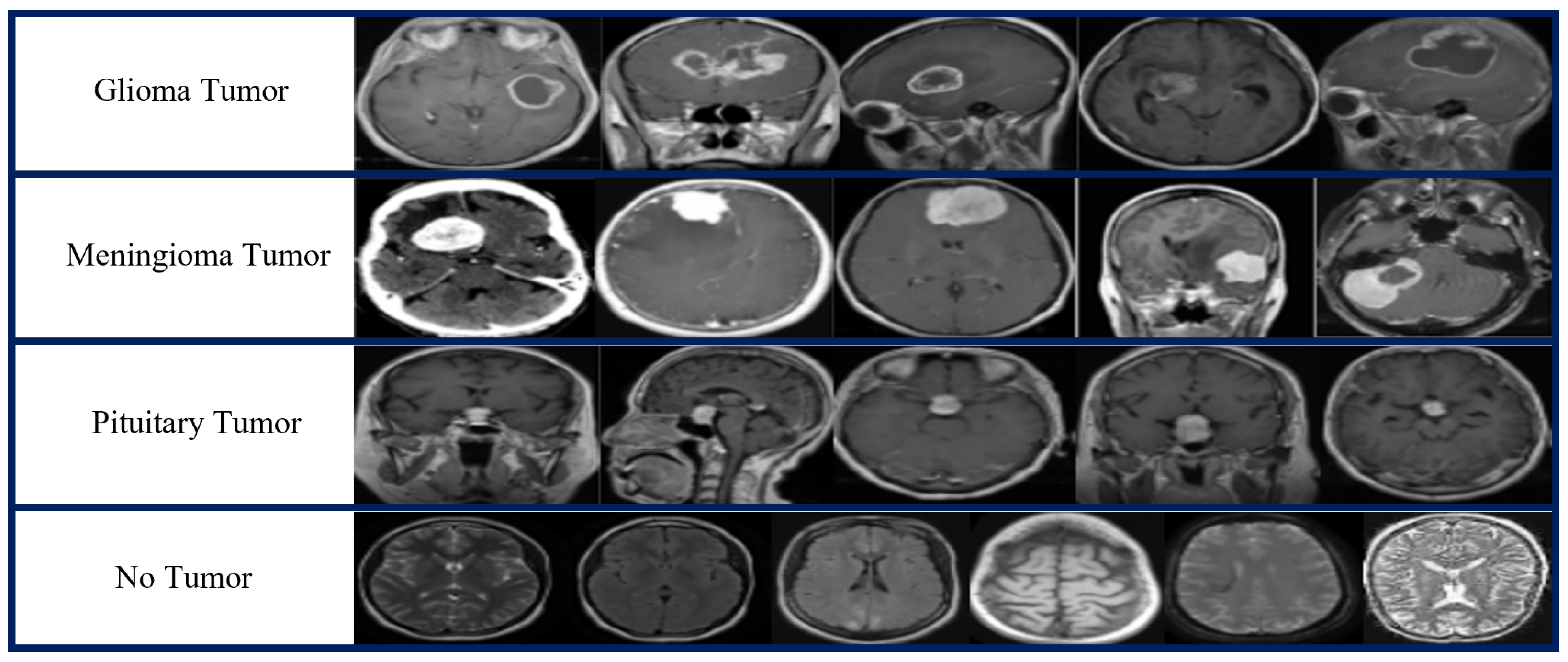 Explainable Deep Learning Approach for Multi-Class Brain Magnetic Resonance Imaging Tumor ...
