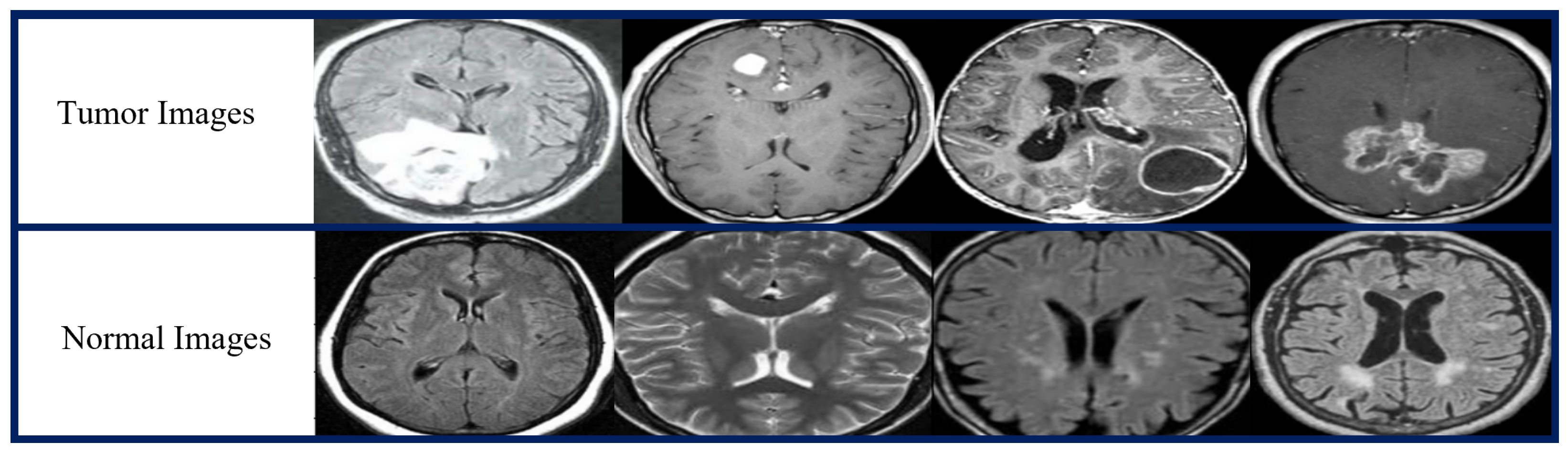 Explainable Deep Learning Approach for Multi-Class Brain Magnetic ...