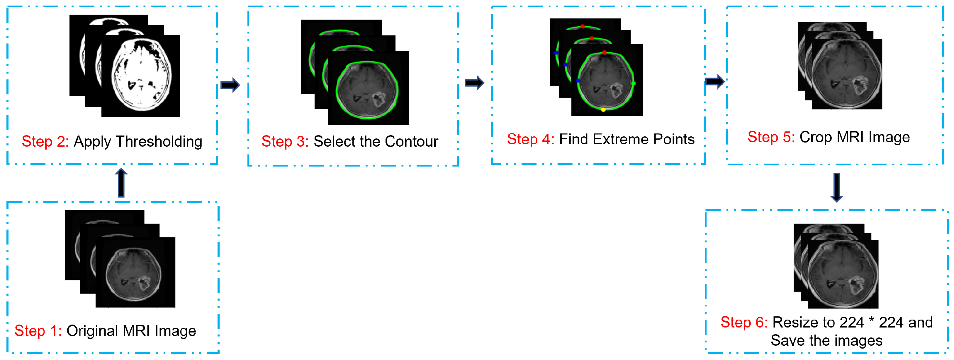 Explainable Deep Learning Approach for Multi-Class Brain Magnetic Resonance Imaging Tumor ...